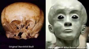 A misteriosa história por trás do StarChild Skull